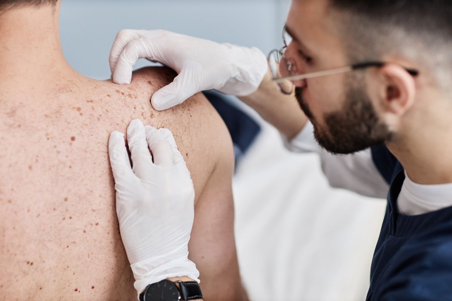 Desinformação e estigmas sobre a hanseníase atrasam cuidados | Dino ...